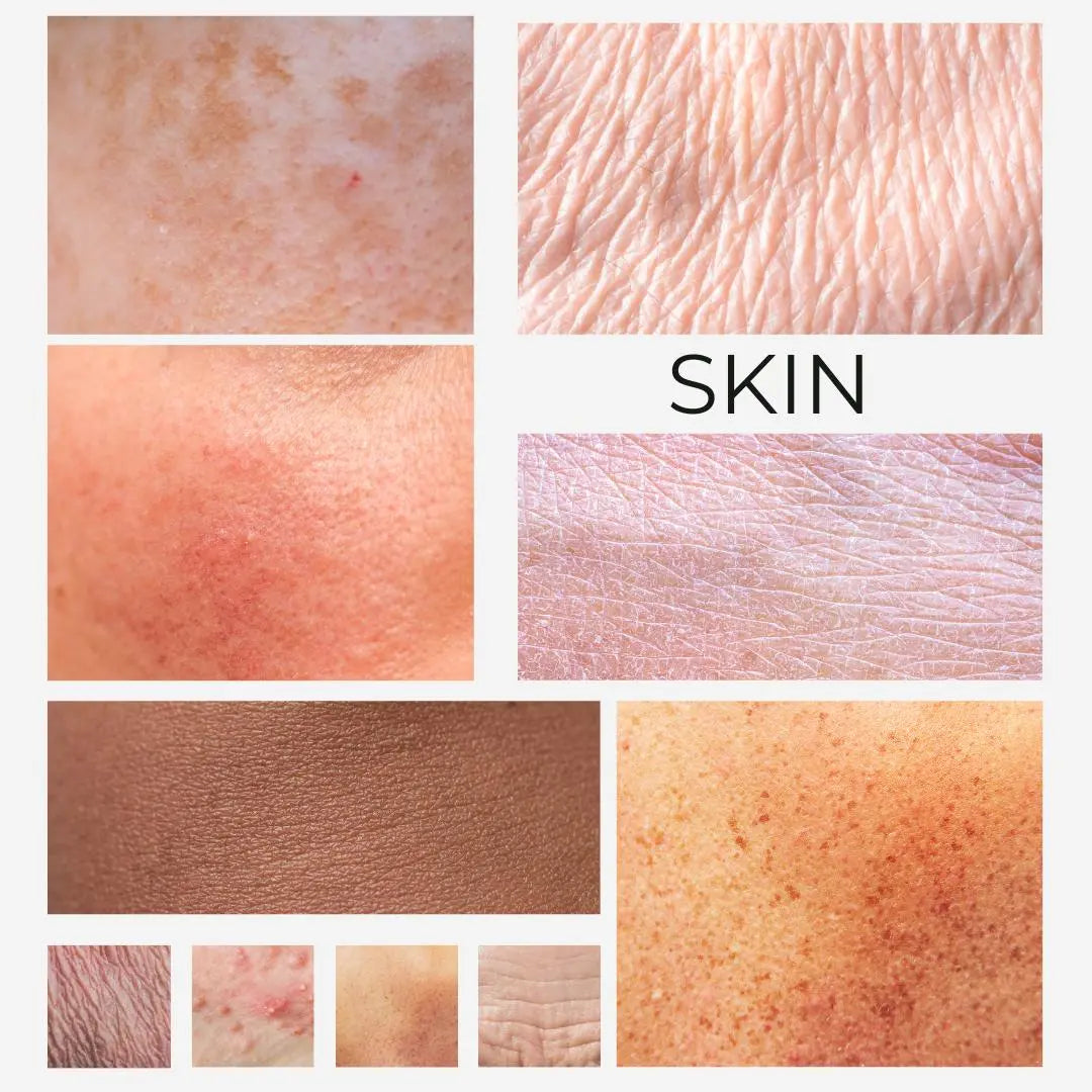 The True Complexity of Skin Types: The Baumann Skin Typing System ...